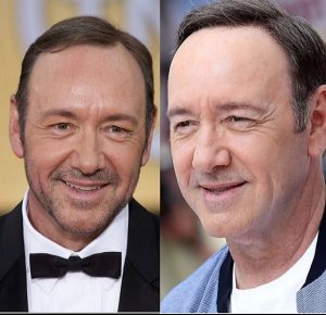 40 Perfect Haircuts for Balding Men (2026 Trends)