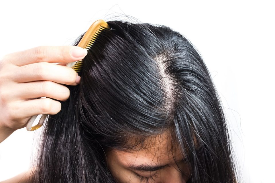 Greasy Hair vs. Shiny Hair: How to Tell the Difference